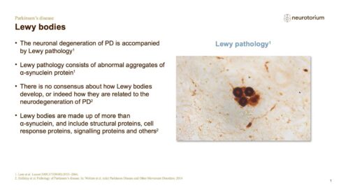 Parkinsons Disease - Neurobiology and Aetiology - Neurotorium