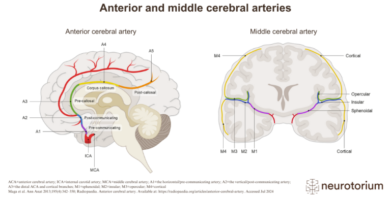 Arteries of the brain - Neurotorium