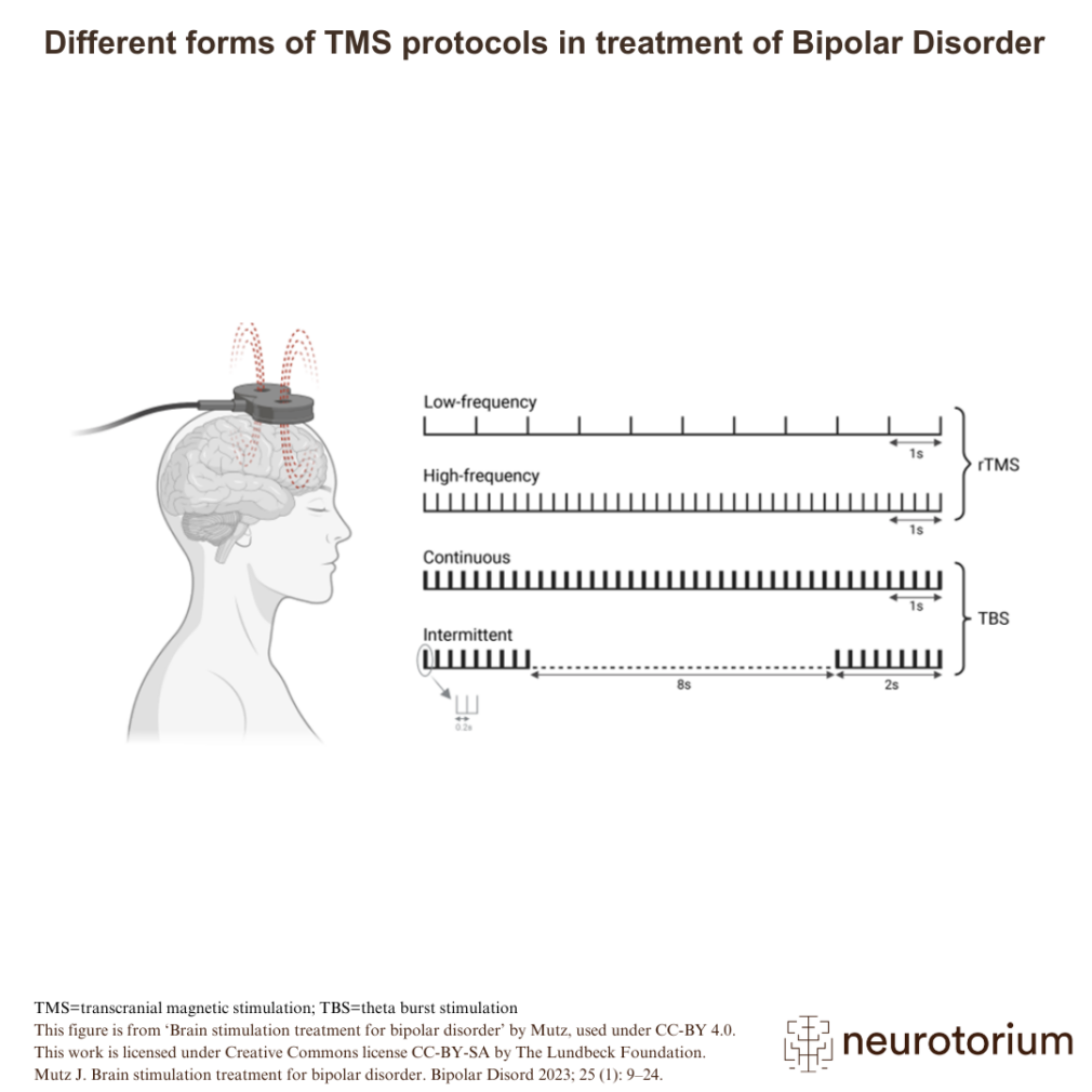 Different forms of TMS protocols in treatment of bipolar disorder ...