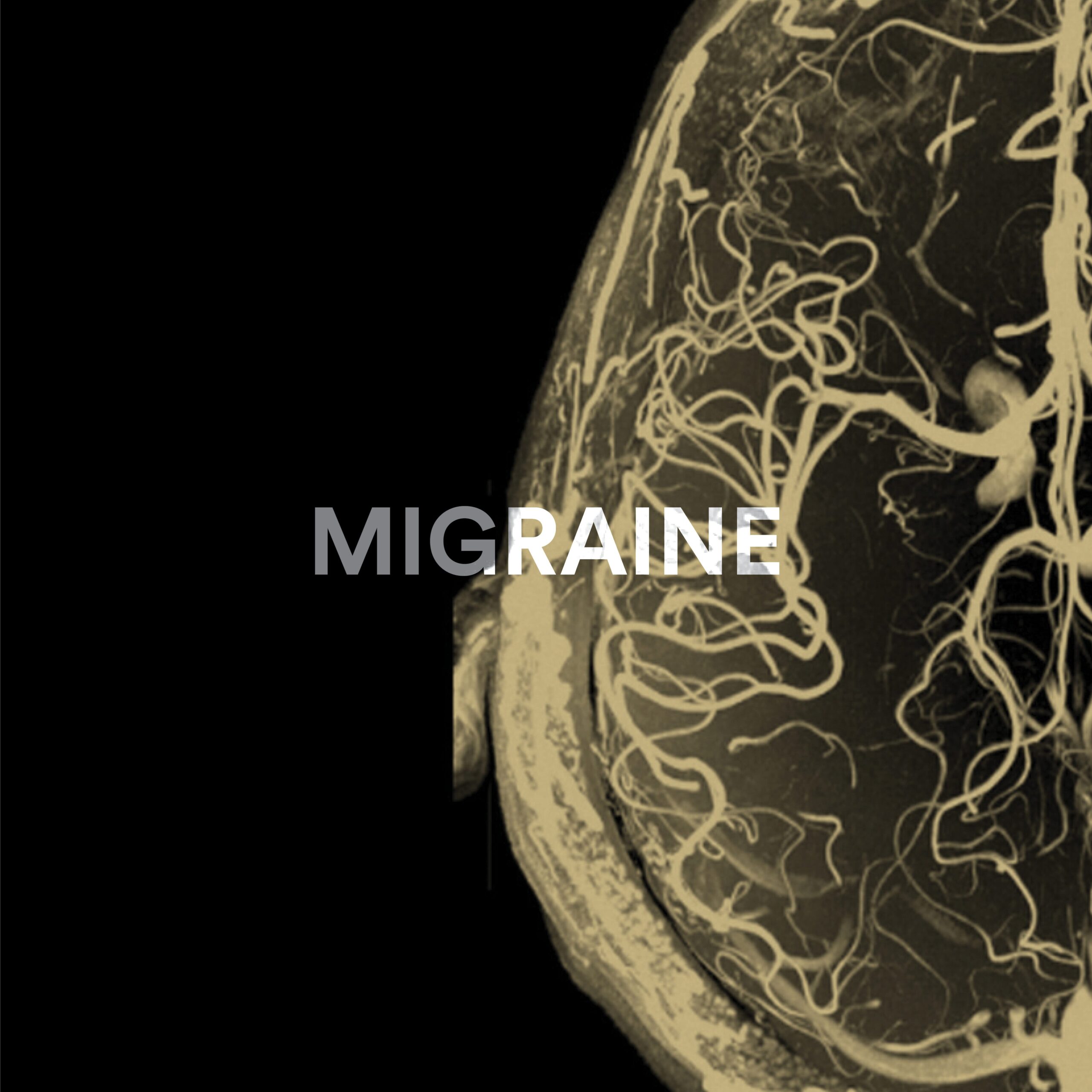 Migraine - Neurotorium