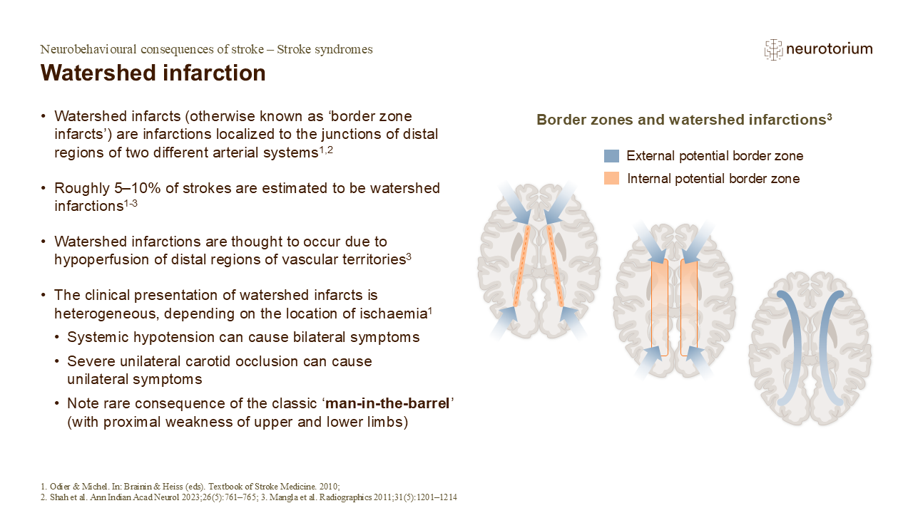 Watershed infarction - Neurotorium