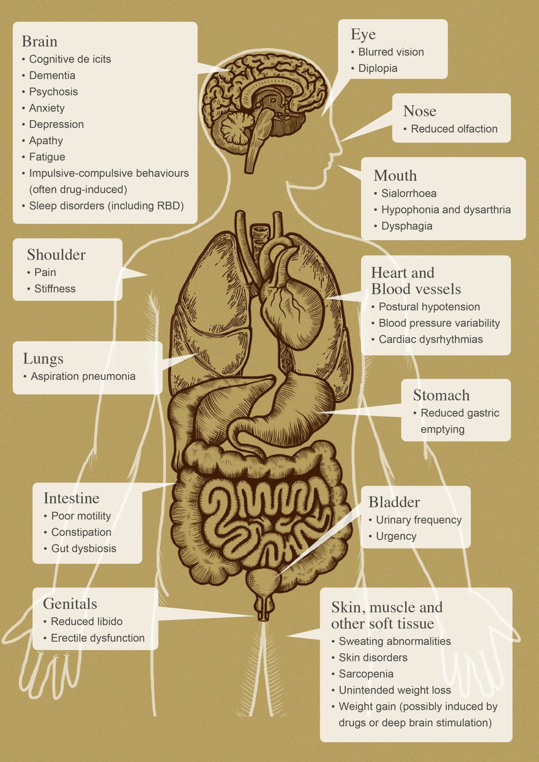 Parkinson's Disease - Neurotorium