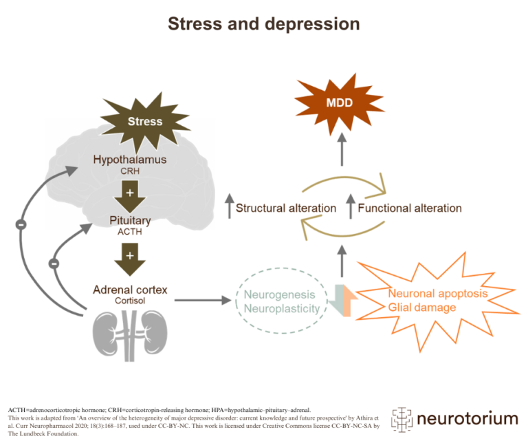 Depression - Neurotorium